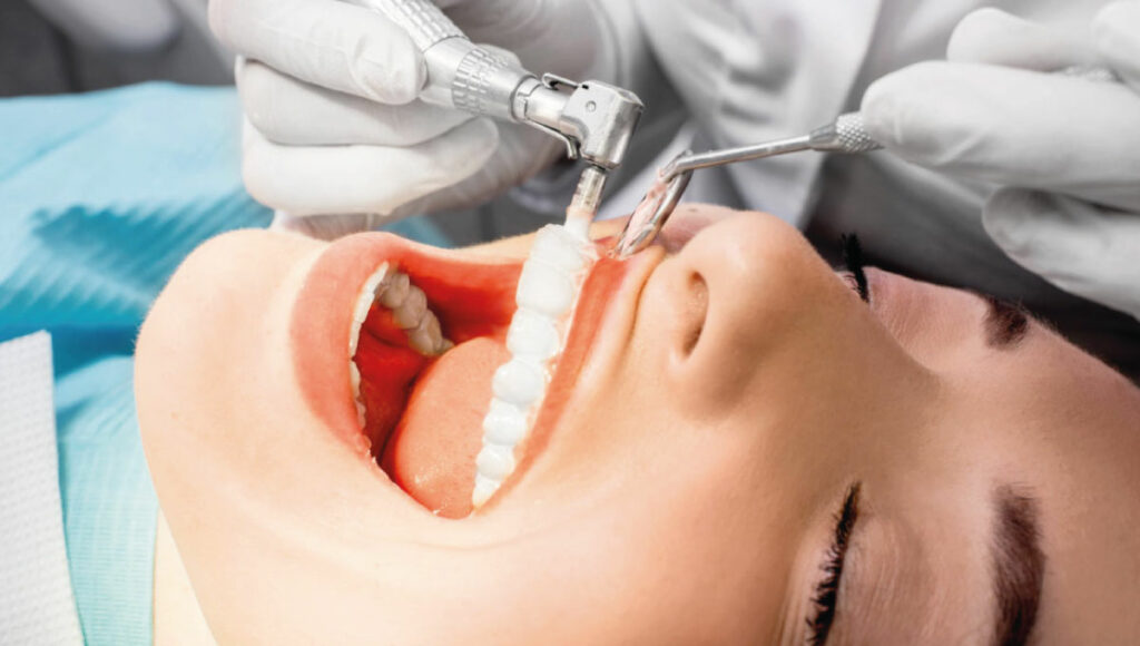 Dental Cleaning Treatment - Dr. Lenia Efthymiou